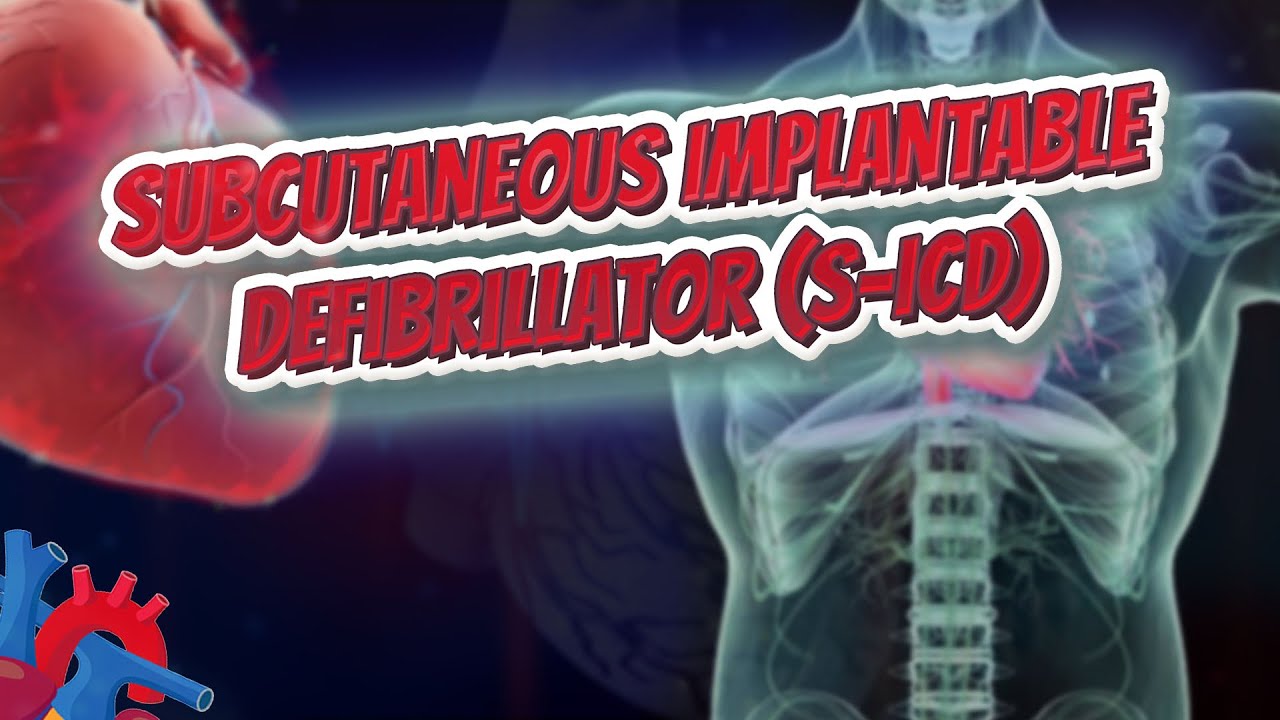 Subcutaneous Implantable Defibrillator S ICD - Human Heart ️ and ...