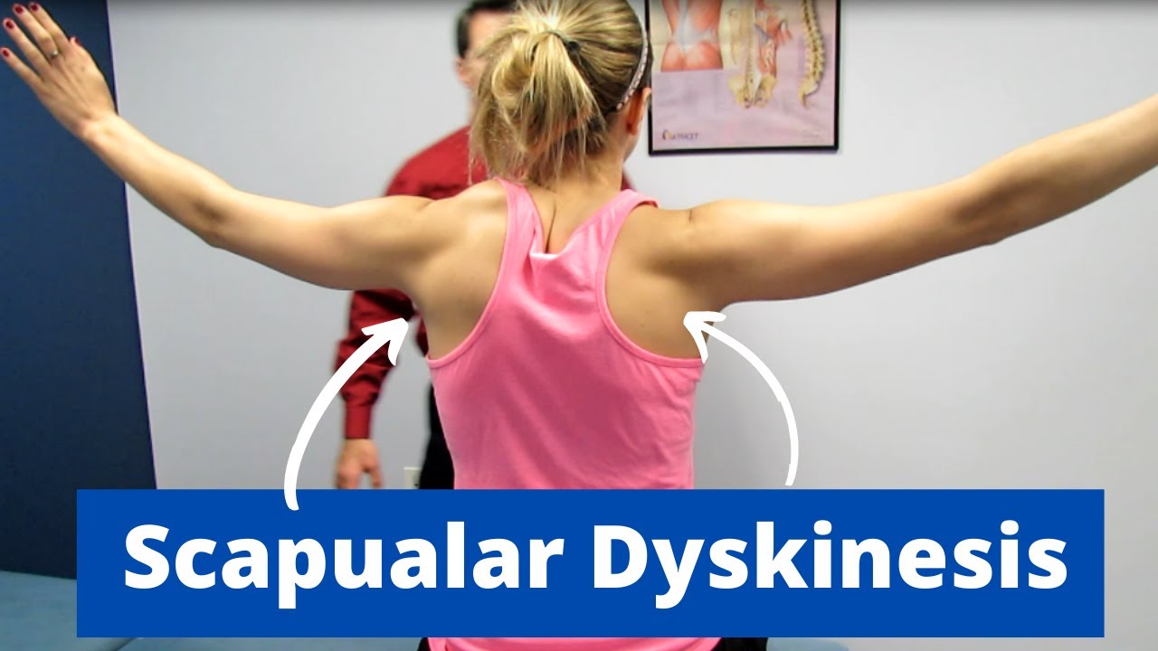 Scapular Dyskinesis Bilaterally - YouTube