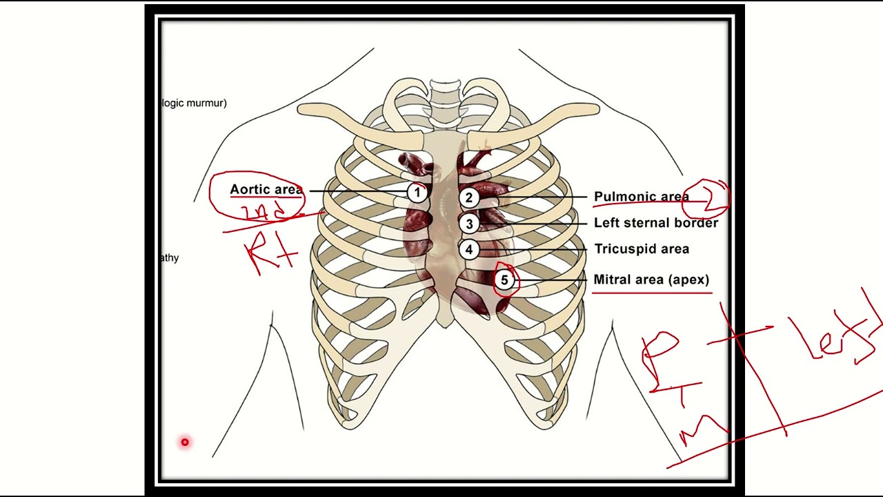Heart valve auscultatory area MRCS question solve (CRACK MRCS) - YouTube