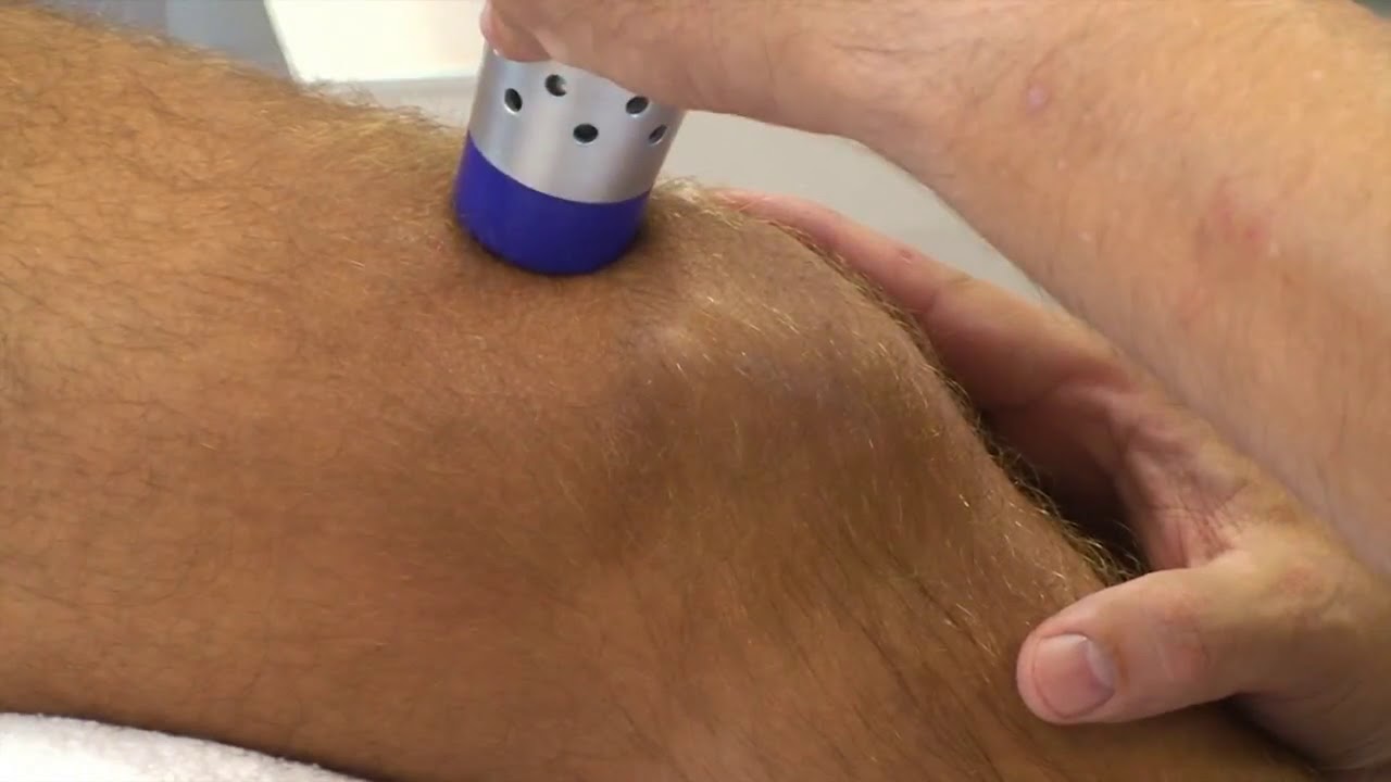 Shockwave Therapy - Treatment for Patellar tendinitis - Atlant Health ...
