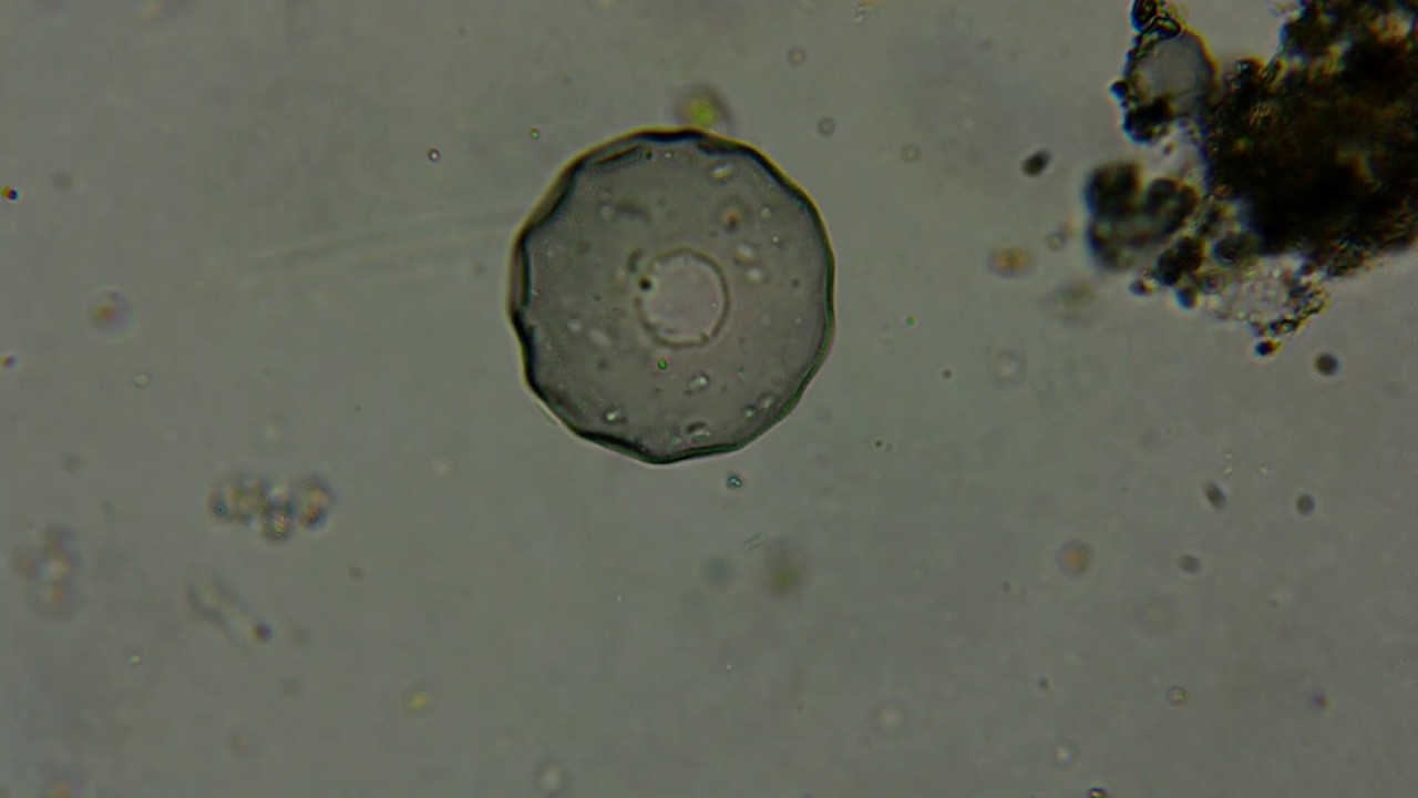Amoeba shell - YouTube