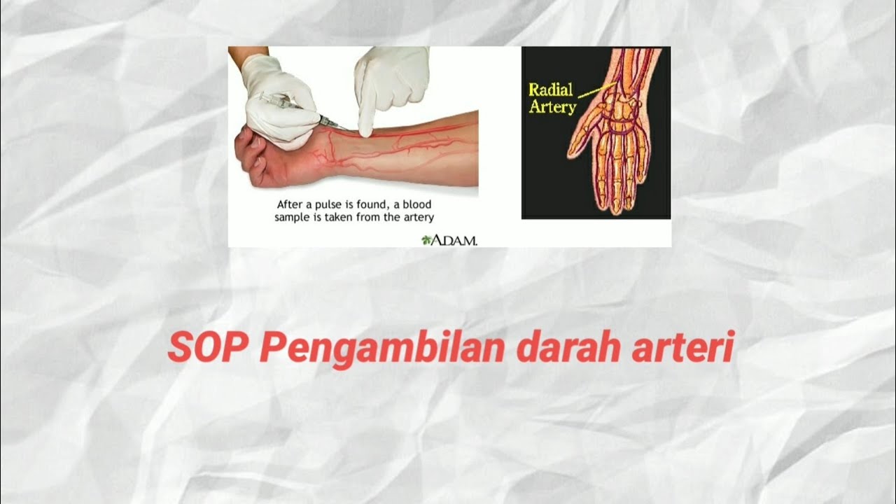 SOP Pengambilan Darah Arteri (Analisa gas darah) - YouTube