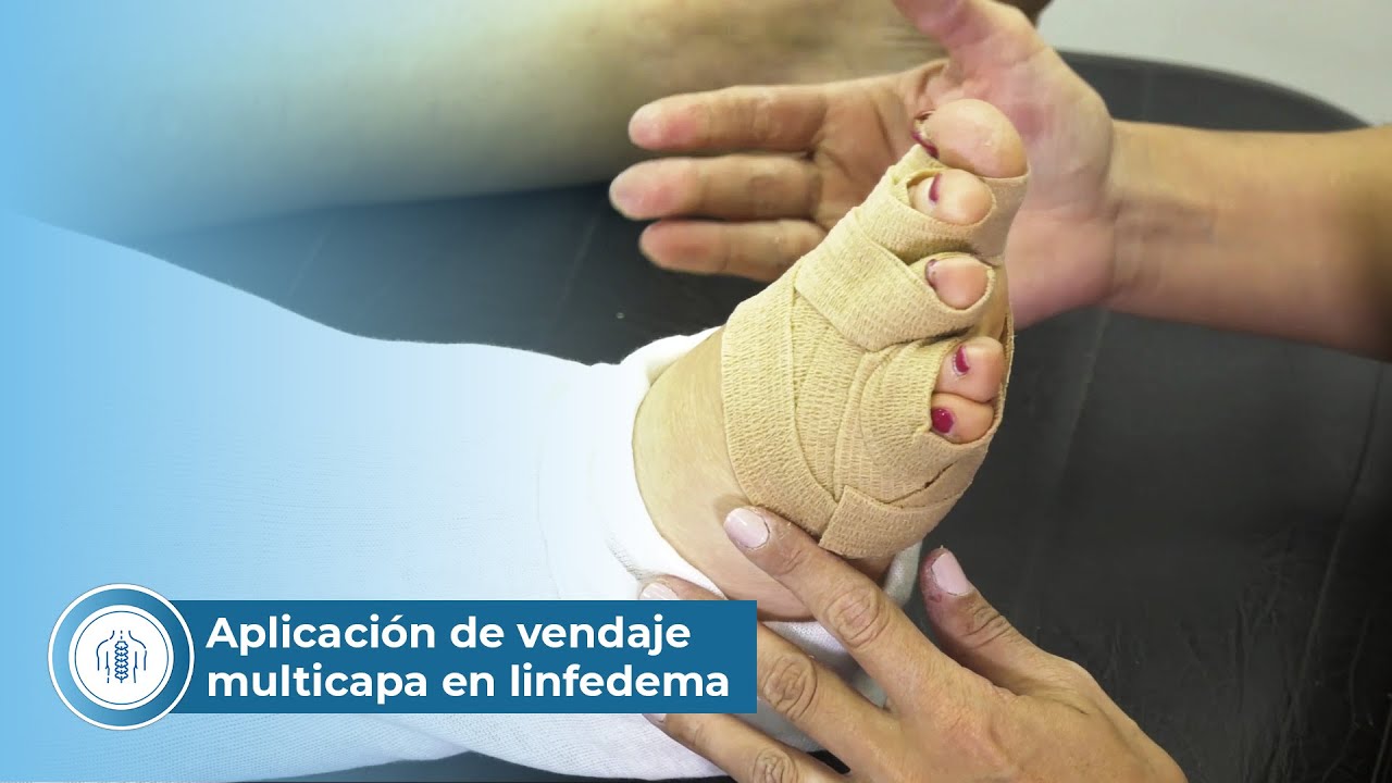 ¿Qué Es Un Vendaje Multicapa _ Vendas y vendajes: Qué son y tipos – MTSIVC