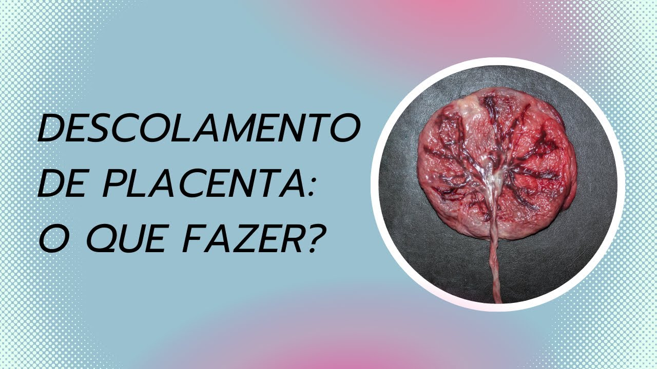 Descolamento de placenta: O que fazer? - YouTube