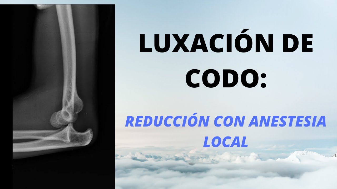 CÓMO SE SOLUCIONA UN CODO LUXADO O DISLOCADO - YouTube