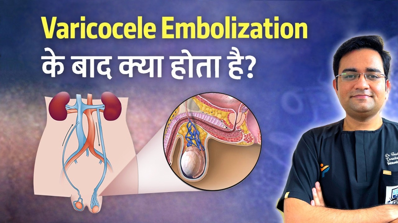 Varicocele Embolization के बाद Recovery कैसी होती है? | Pain ...