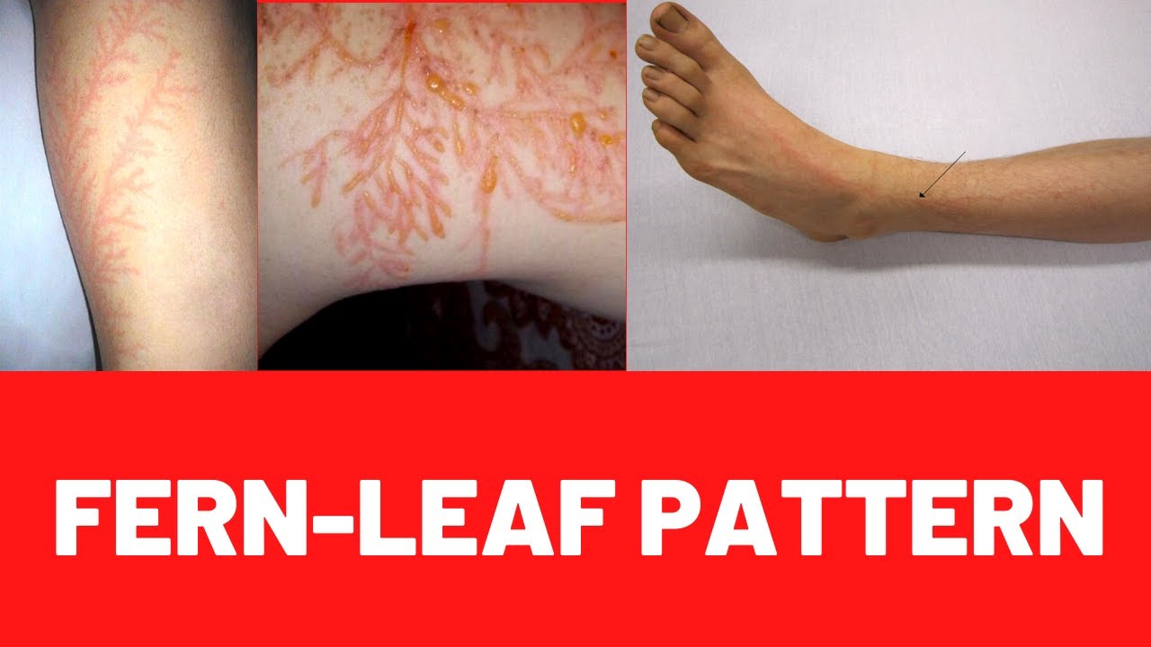 Is Lightning Strike Causing This? - YouTube