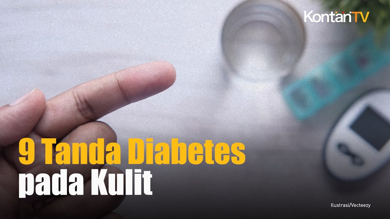 9 Tanda Diabetes yang Bisa Muncul pada Kulit, Jarang Diketahui | Info ...