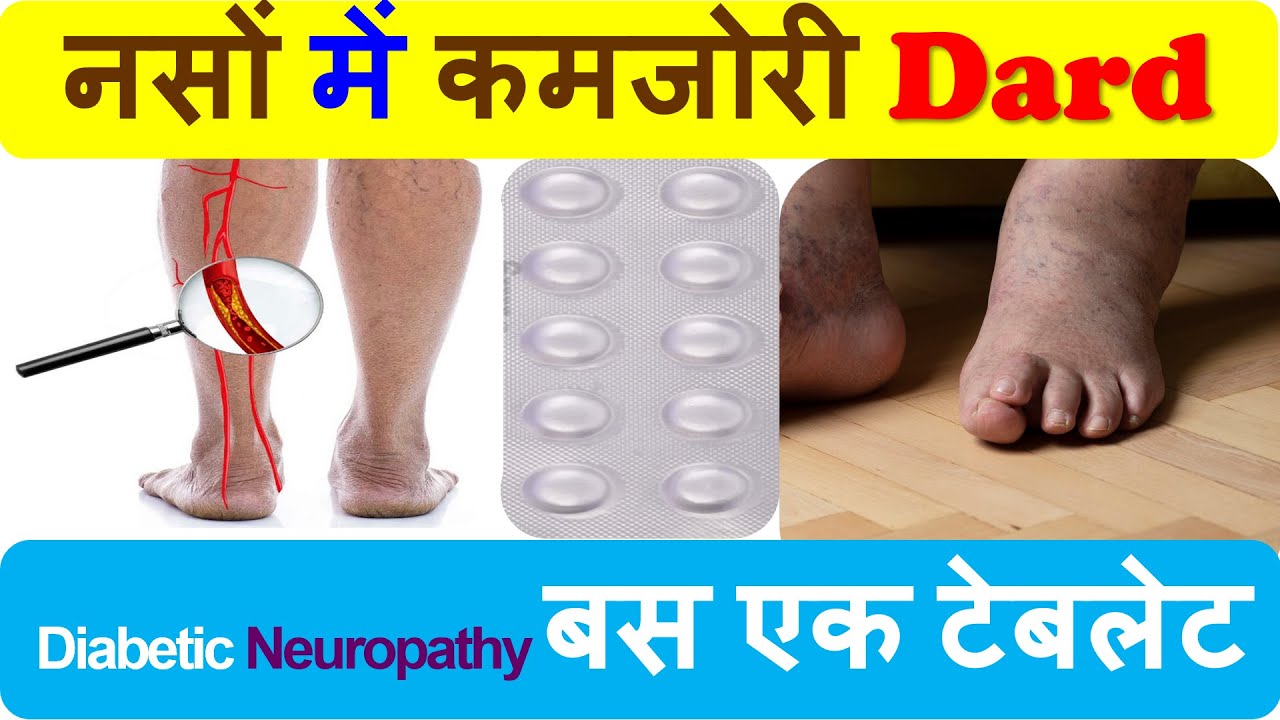 पुराने से पुराने नसों के दर्द के दवा | Nurogab 75 tablet | nerve pain ...