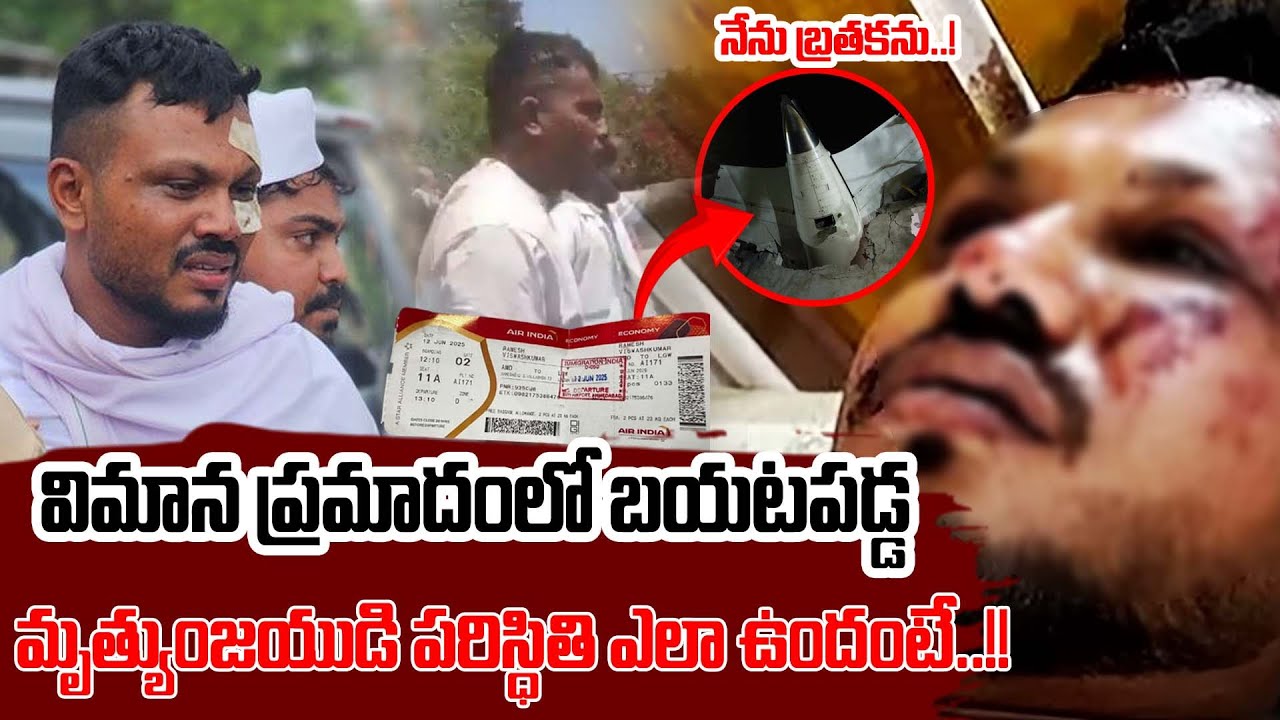 Vishwas Kumar Ramesh Health Condition | Ahemadabad Plane Crash ...