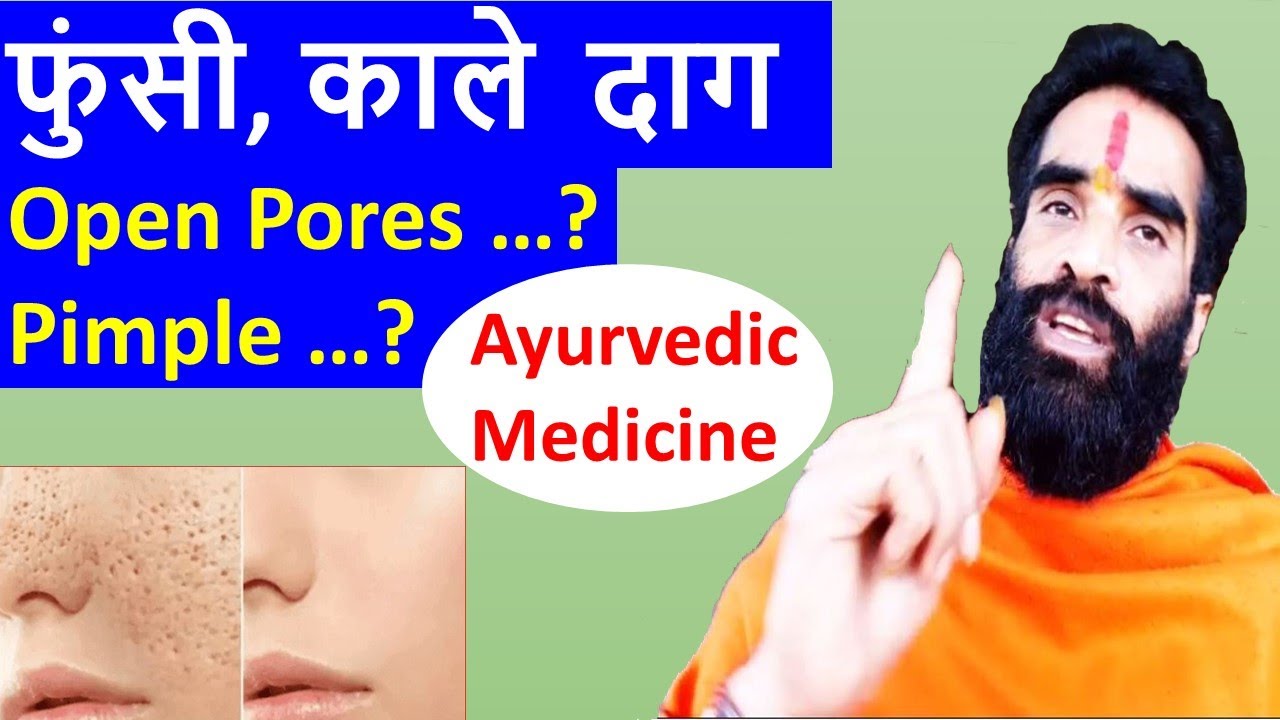 Acne treatment | Face pimple remove | open pores treatment - YouTube