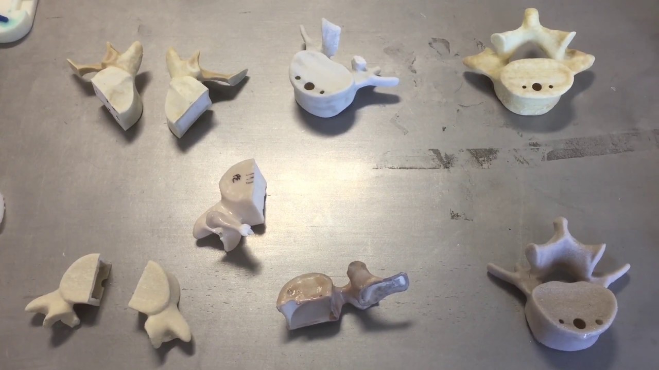 NTU research into 3D printing replica human bones - YouTube