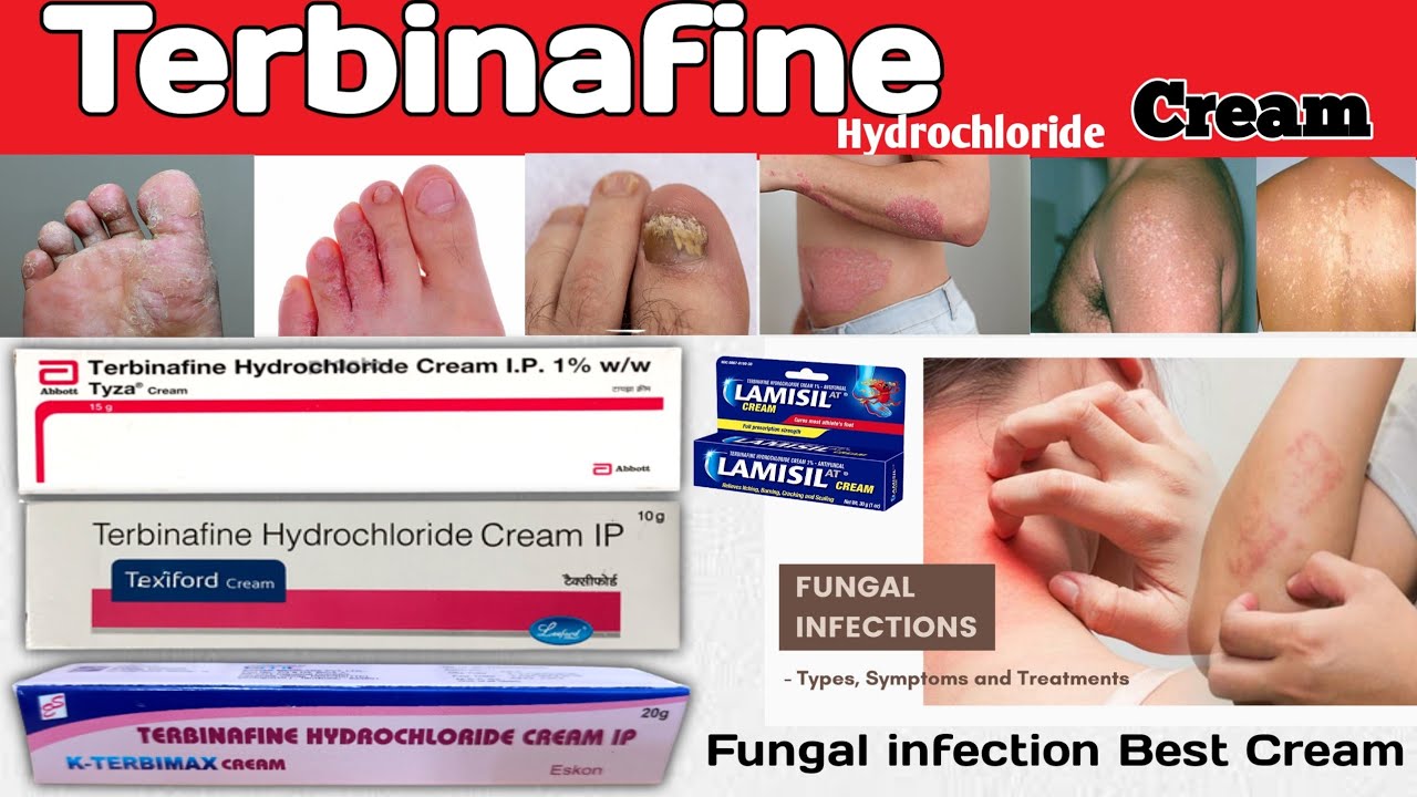 Terbinafine Hydrochloride cream uses in Bangali // Tyza Cream ...