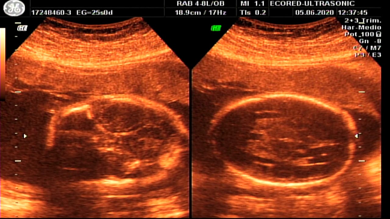 Rayen flower - YouTube