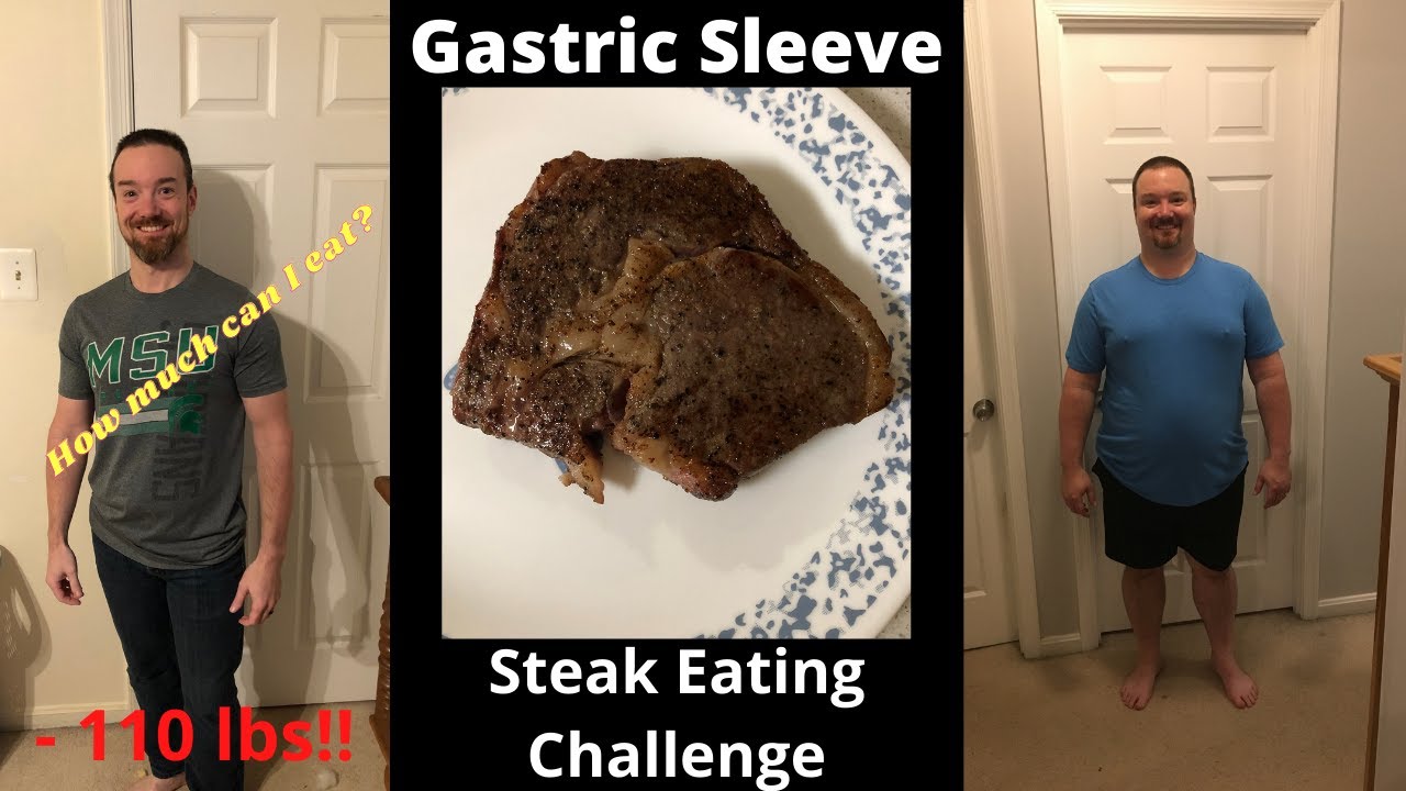 Gastric Sleeve Steak Eating Challenge - YouTube