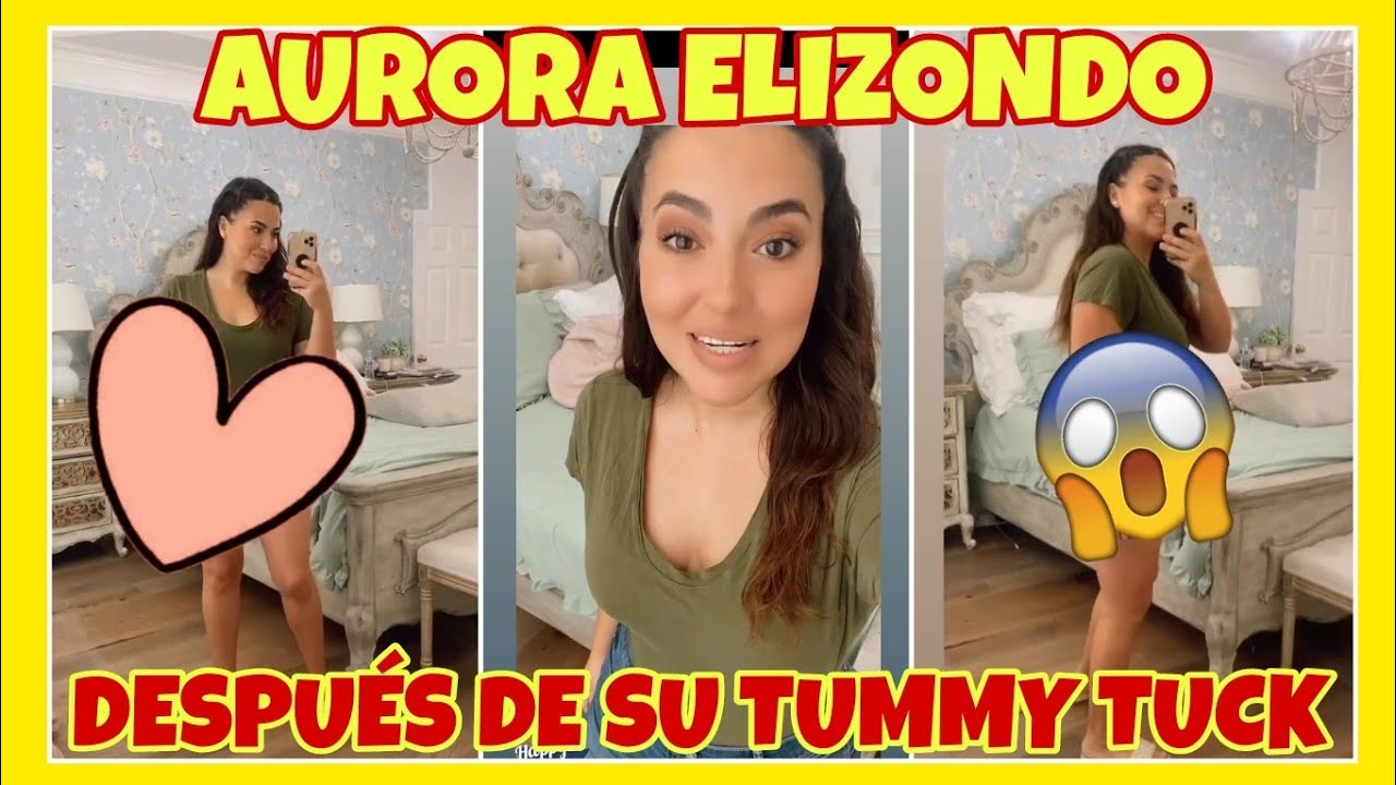 ASÍ LUCE AURORA EIZONDO A 3 SEMANAS DE SU TUMMY TUCK 🙊 - YouTube