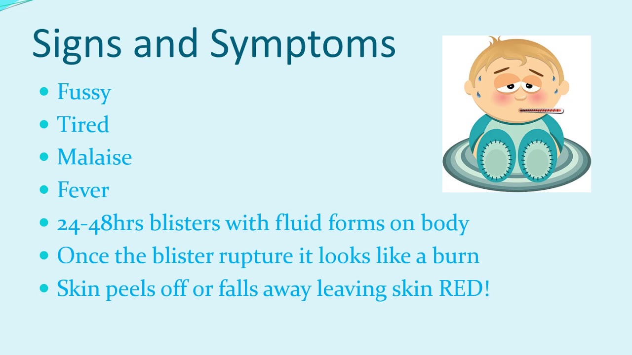 Staphylococcal scalded skin syndrome SSSS - YouTube