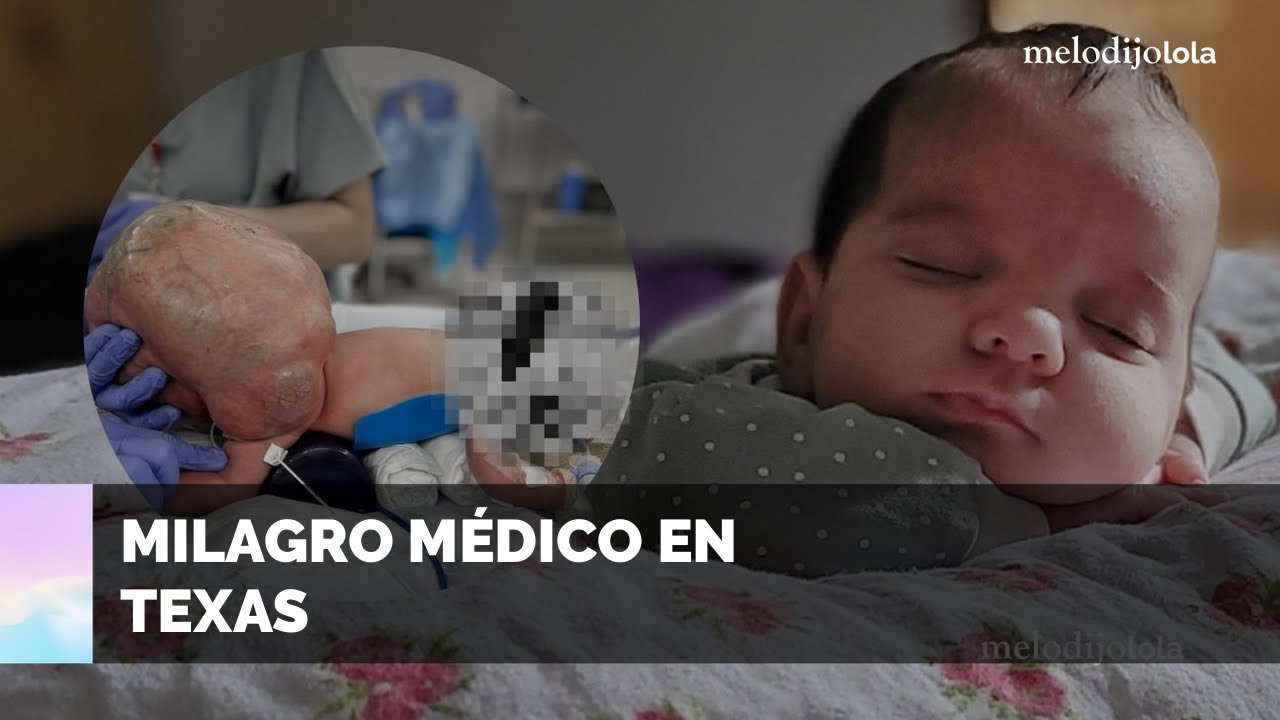 Historia de Adalida: la bebé que sobrevivió a un tumor de 2 kilos ...