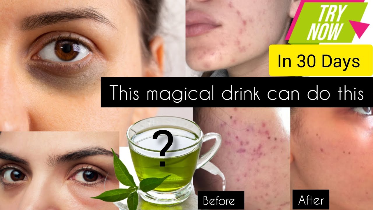 Try Matcha for 30 Days and see the result 😱//এই ড্রিংক টা মুখের দাগ ...