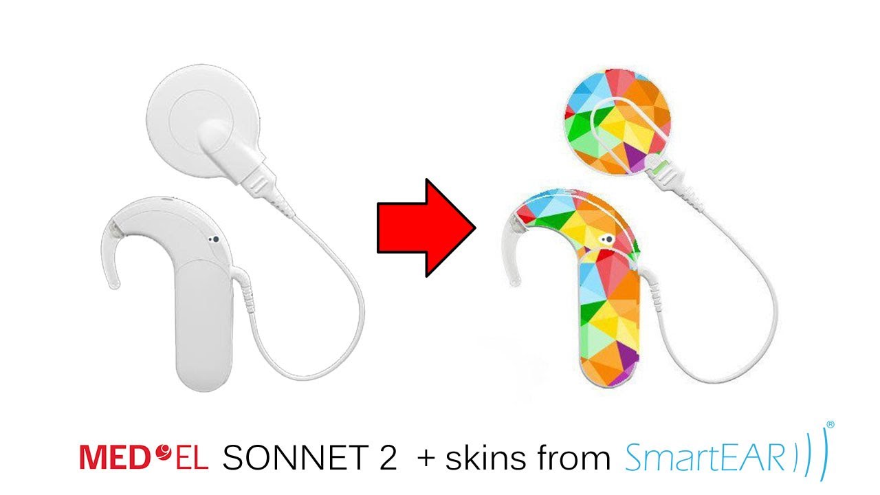 Installing a SmartEar skins on a MED-EL Sonnet 2 audio processor ...