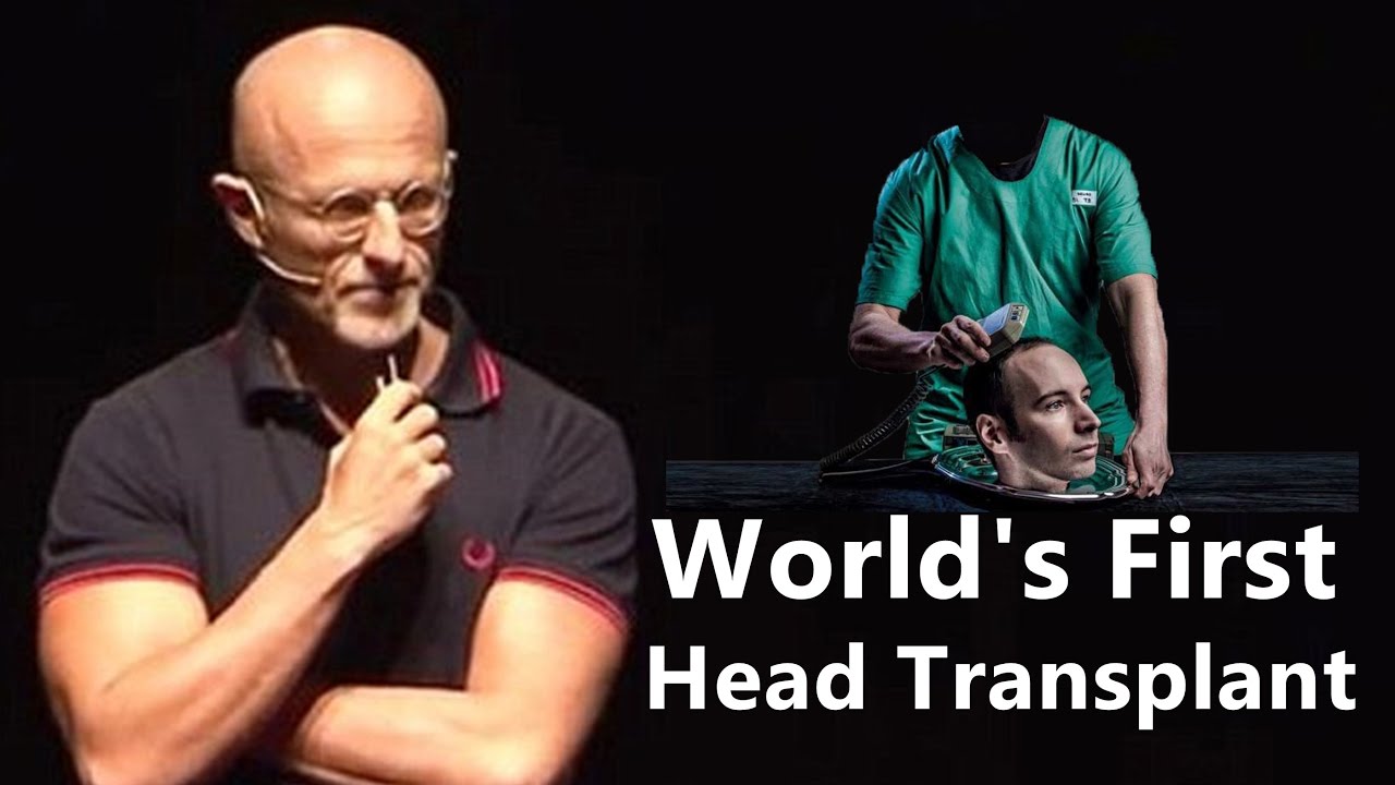 World's First Human Head Transplant by Dr Sergio Canavero in 2017 - YouTube