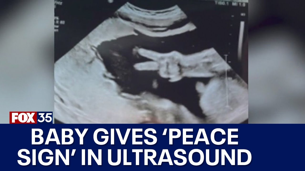 Ultrasound photo of baby giving 'peace sign' goes viral - YouTube