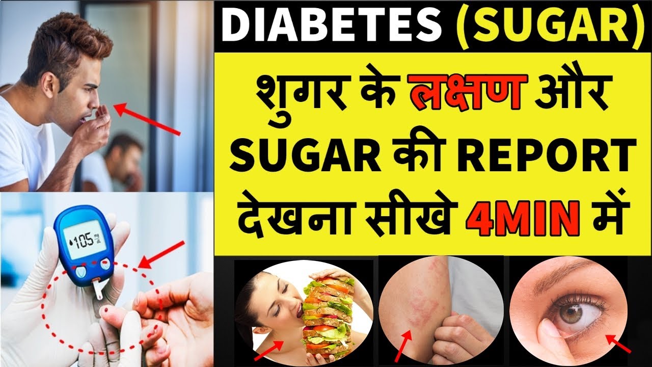 Sugar Ke Lakshan Diabetes Symptoms In Hindi Sugar Ki Report Kaise Sugar Ke Lakshan Diabetes Symptoms In Hindi Sugar Ki Report Kaise