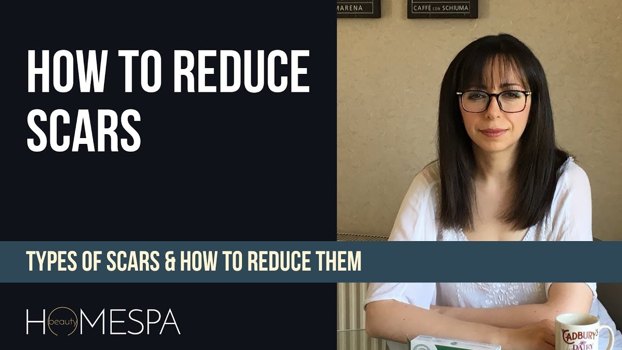 How To Reduce Scars - Helpful Tips & Skincare Treatments - YouTube