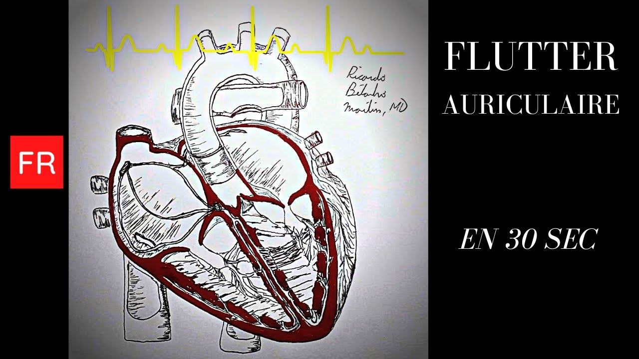 Arythmies (Animation cardiaque et ECG) - Flutter auriculaire #Shorts ...