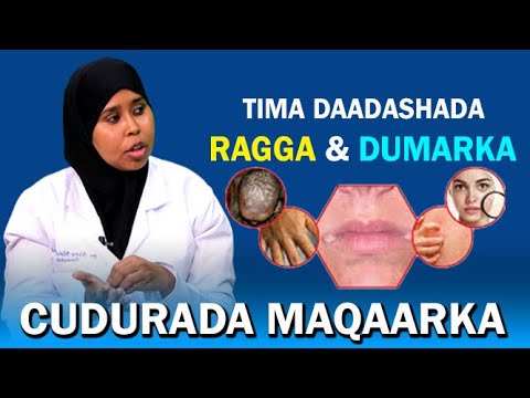 Drs. Nasro Maxamed Axmed " Timo Daadashada Dumarka & Ragga Waxaa u ...
