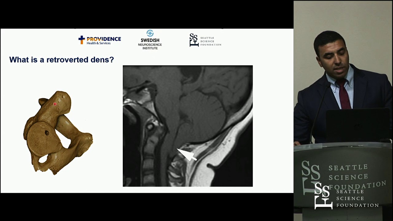 The Retroverted Dens Overview - Basem Ishak, M.D. - YouTube