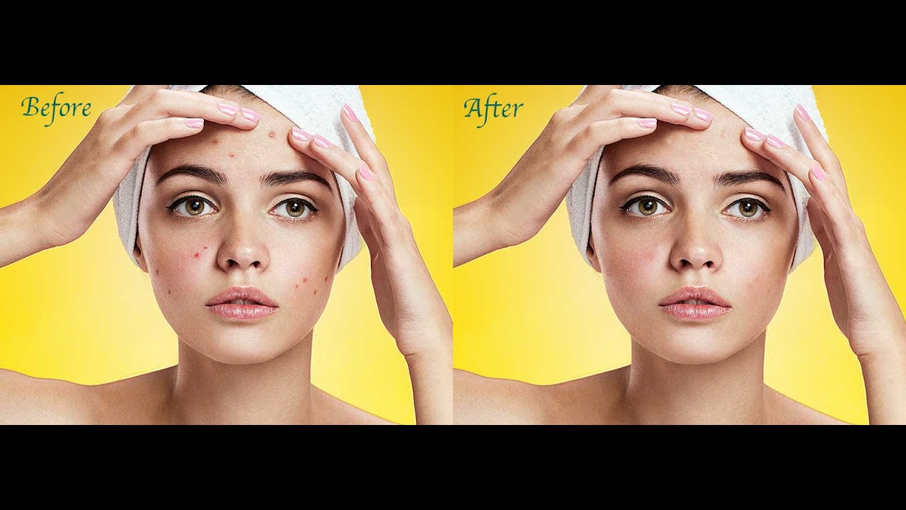How To Remove Pimples Adobe Photoshop Urdu Hindi YouTube how-to-remove-pimples-adobe-photoshop-urdu-hindi-youtube