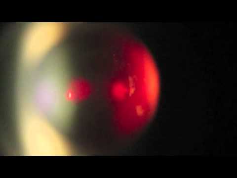 weissring treated by Feike Gerbrandy English version - YouTube