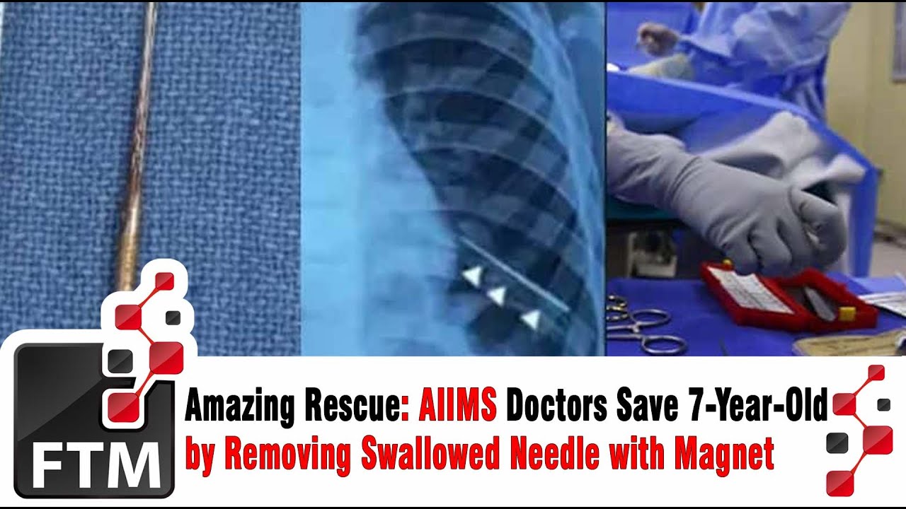 Amazing Rescue: AIIMS Doctors Save 7 Year Old by Removing Swallowed ...