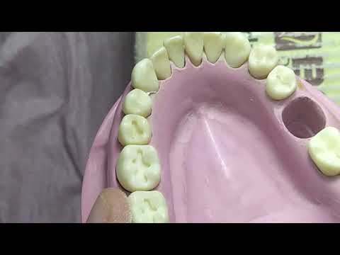 Class 1 Lower 7 cavity preparation for amalgam restoration - عربي - YouTube