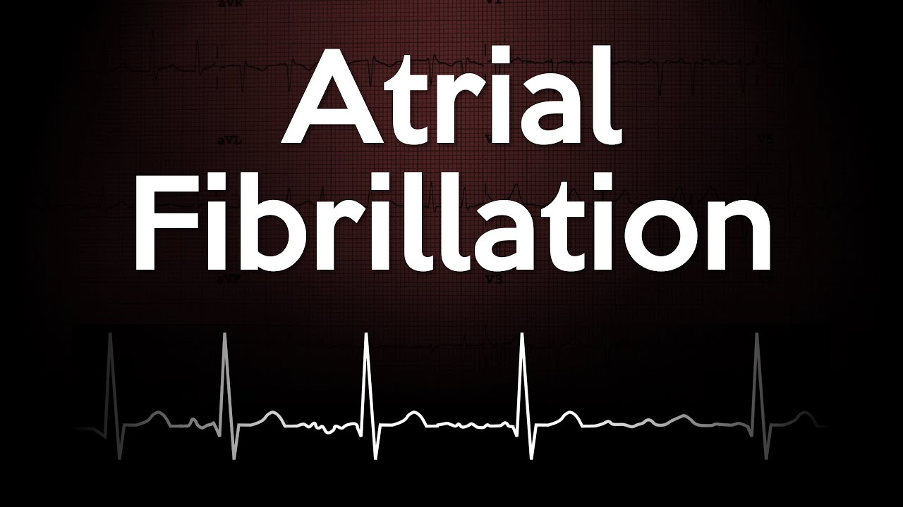 Atrial Fibrillation Ecg Explained Youtube