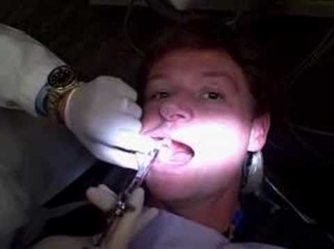 dentist novocaine shot - YouTube