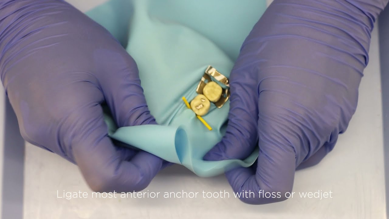 Rubber dam placement - YouTube