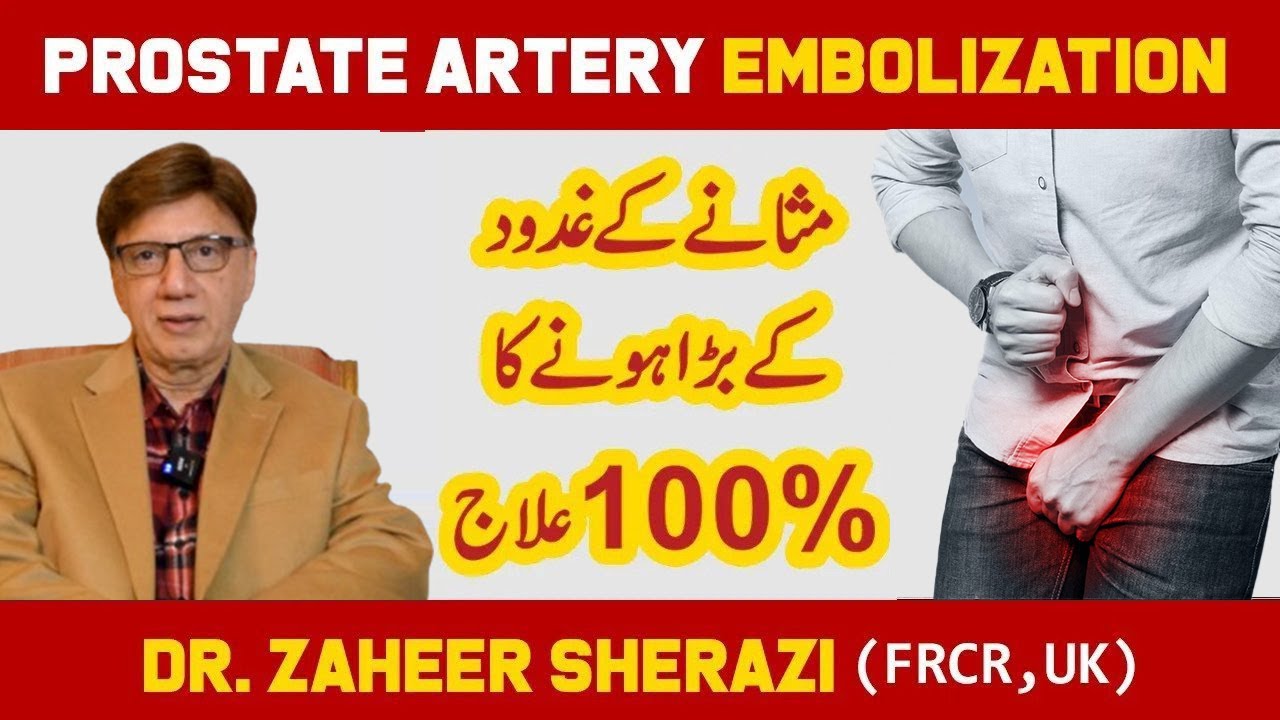 Say Goodbye to Enlarged Prostate | Prostatic Artery Embolization in ...