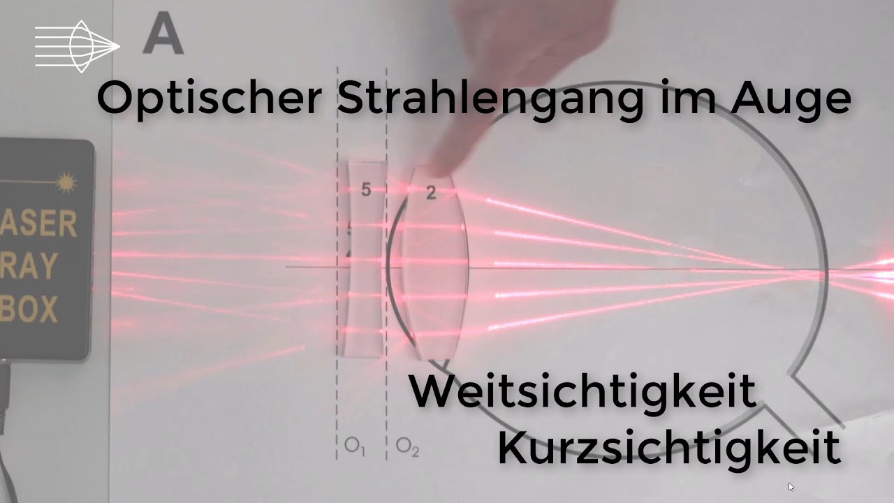 Optischer Strahlengang im Auge, Weitsichtigkeit, Kurzsichtigkeit ...