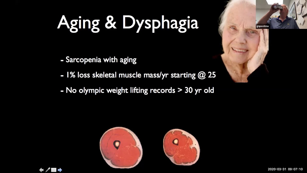 Dysphagia & Transnasal Esophagoscopy I - Dr. Gregory Postma - YouTube