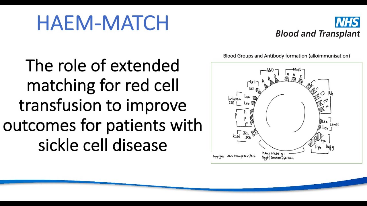 The role of extended matching for red cell blood transfusion to help ...