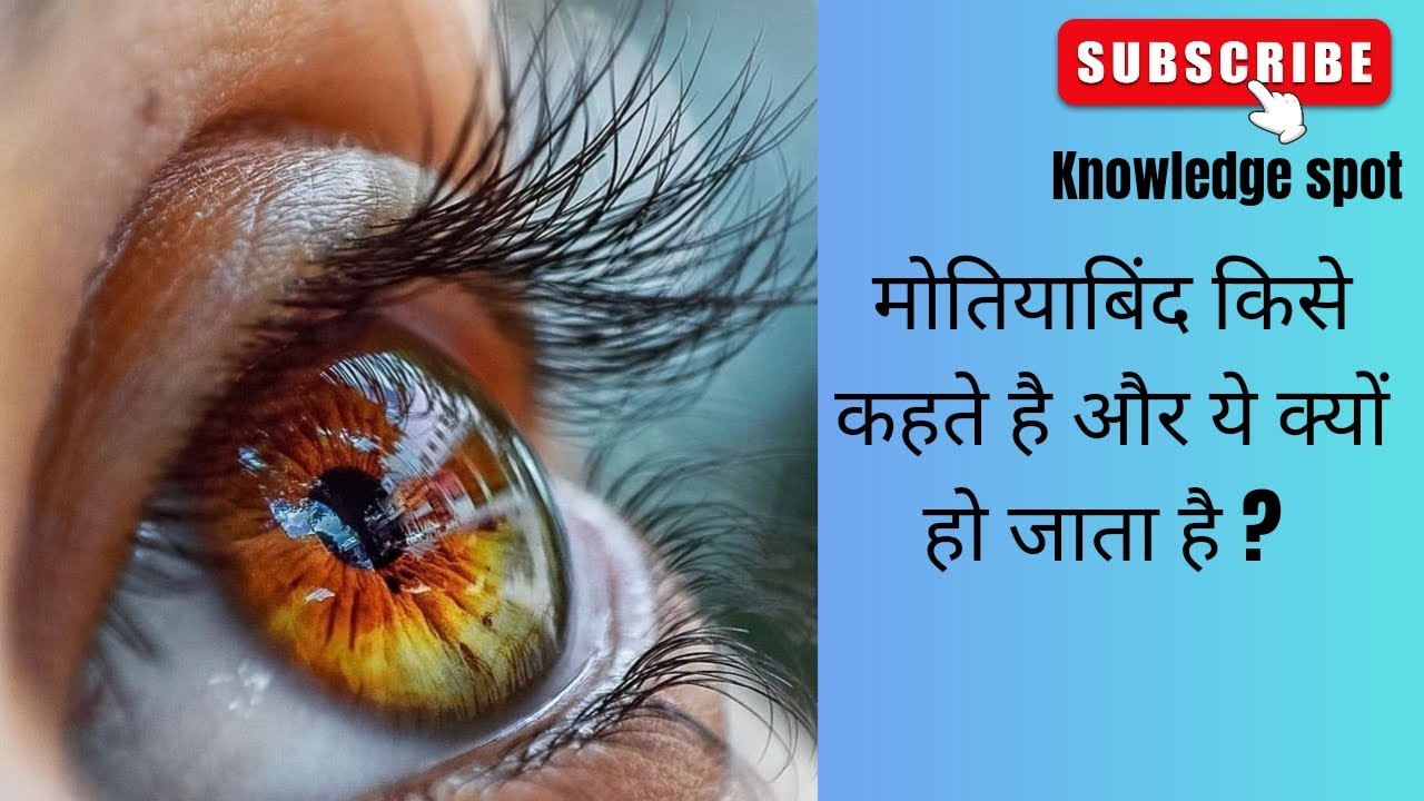 मोतियाबिंद किसे कहते है और ये क्यों हो जाता है ? @knowledge_spot - YouTube