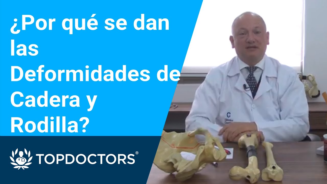 ¿Por qué se dan las Deformidades de Cadera y Rodilla? - YouTube