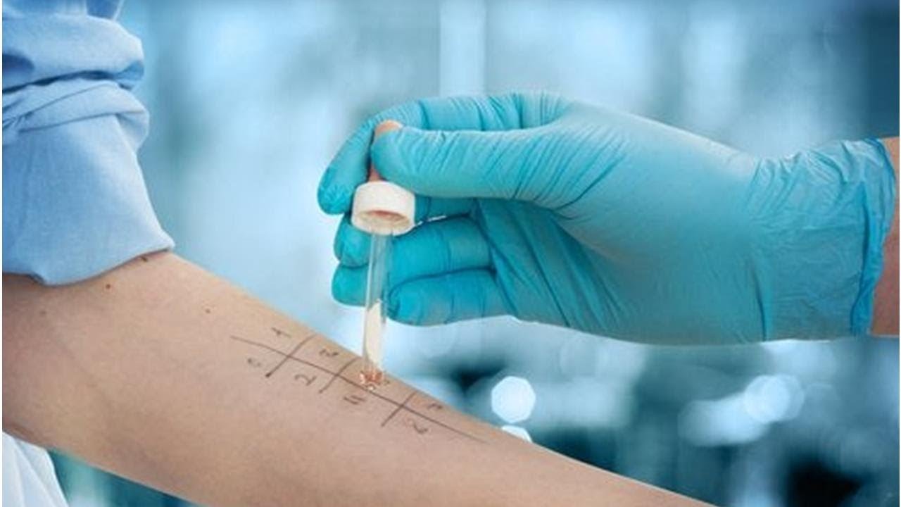 Pruebas de la alergia, ¿en qué consisten? | Maha TV - YouTube