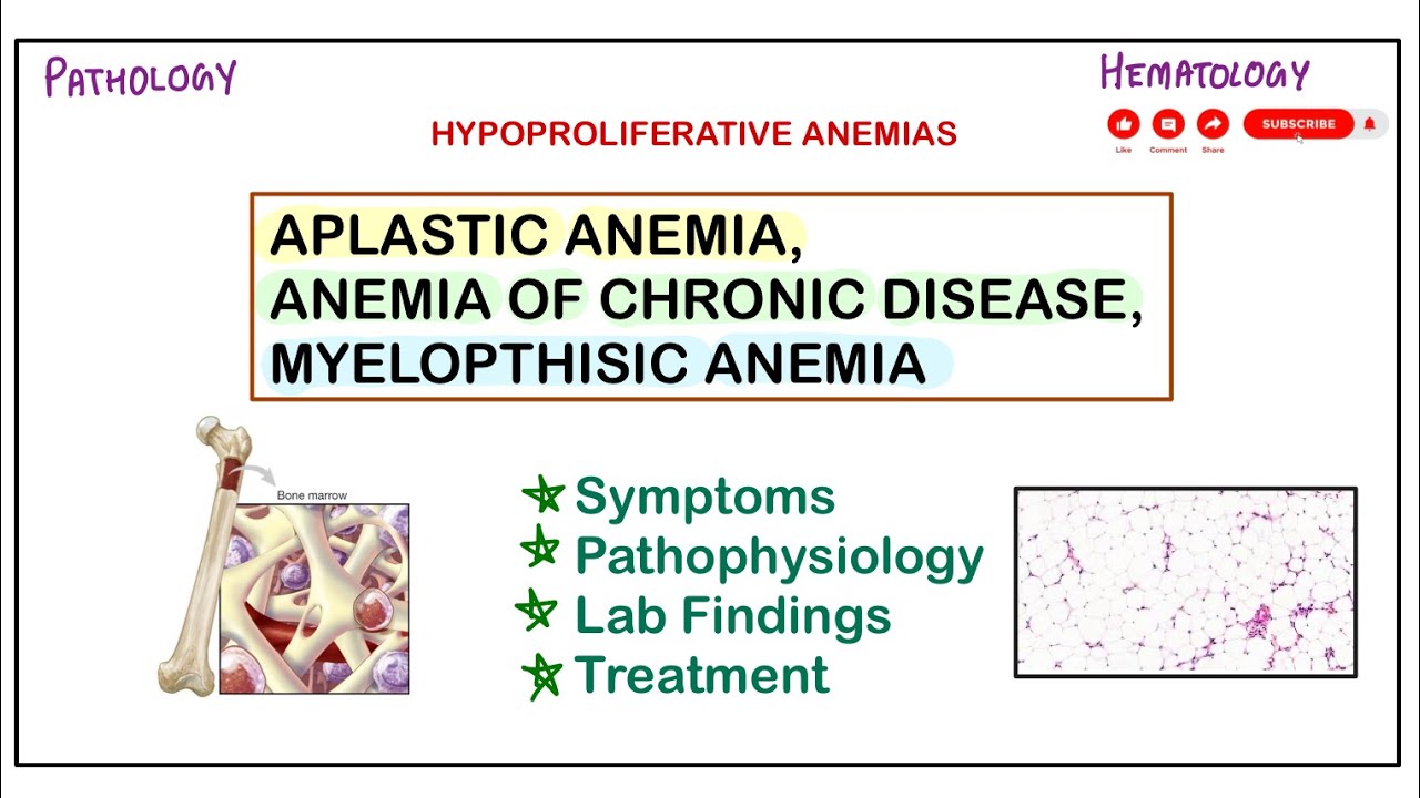 Hypoproliferative Anemias | Aplastic Anemia,Myelopthisic Anemia,Anemia ...