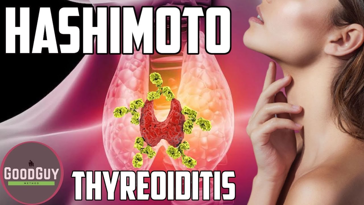Hashimoto Thyreoiditis hat viele Ursachen! Immunsystem Entzündungen ...