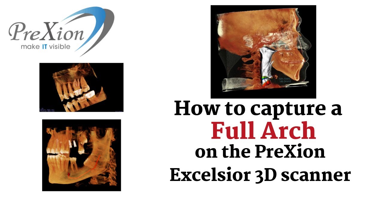 Full arch training video - YouTube