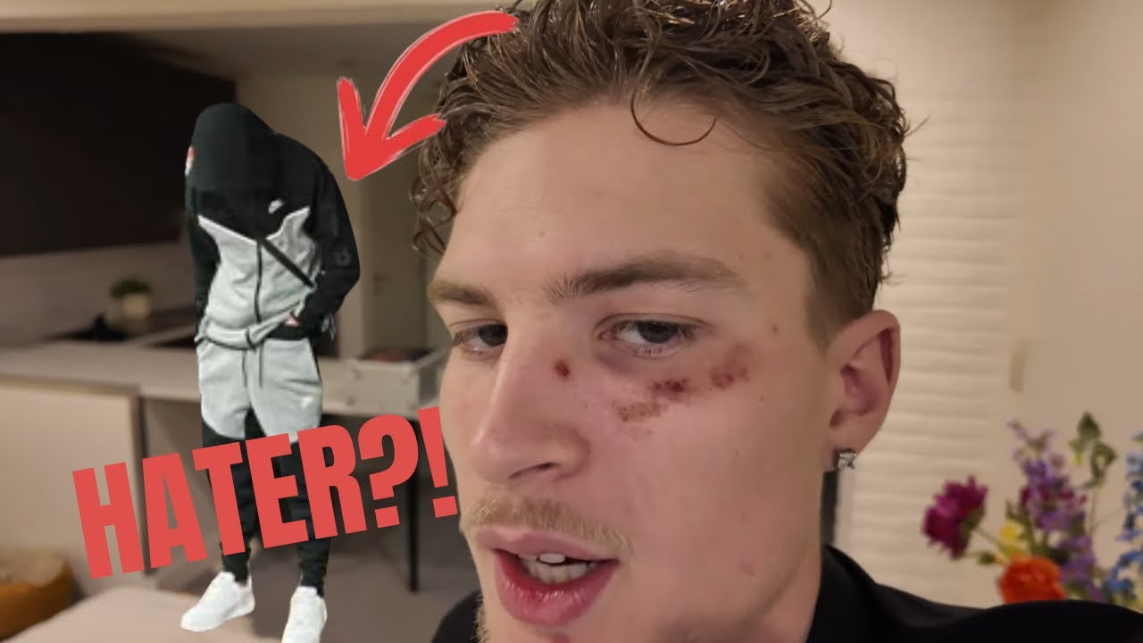 WAT HEB IK AAN MIJN OOG??!!.😱😱 - YouTube