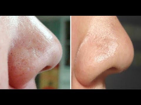 Яичная Маска-Пленка 3 в 1! Подтяжка, Укрепление и Очищение! - YouTube